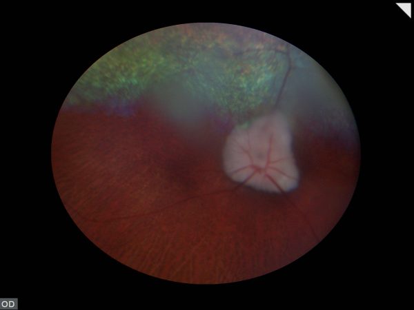 PROGRESSIVE RETINAL ATROPHY (PRA) – Dres Licon Veterinary Ophthalmology ...